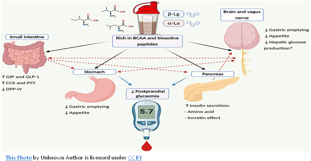 Exploring Diabetes: Explaining the Various Types and Their Root Causes ...